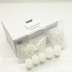 Blood Total RNA Extraction Kit (Genomic DNA Removal) - DNA Testing Experts