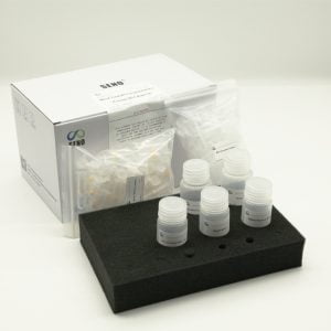 Blood Total RNA Extraction Kit (Genomic DNA Removal) - DNA Testing Experts