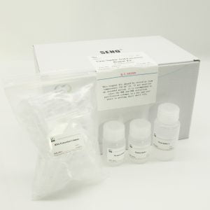Virus Nucleic Acid Purification Reagent Kit - DNA Testing Experts