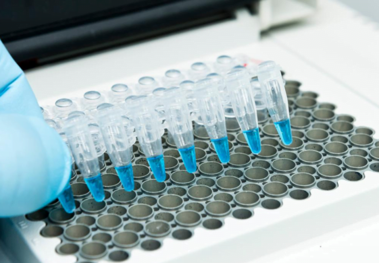 PCR-SSCP 란 무엇입니까?? 응용 프로그램 및 전체 가이드 - DNA 테스트 전문가